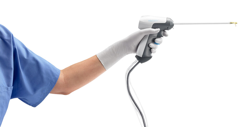 Urologia al Miulli: nuovo trattamento "Rezum" non chirurgico per l ...