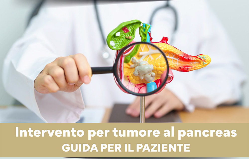 Tumore al pancreas: il Miulli presenta la guida per il paziente - miulli